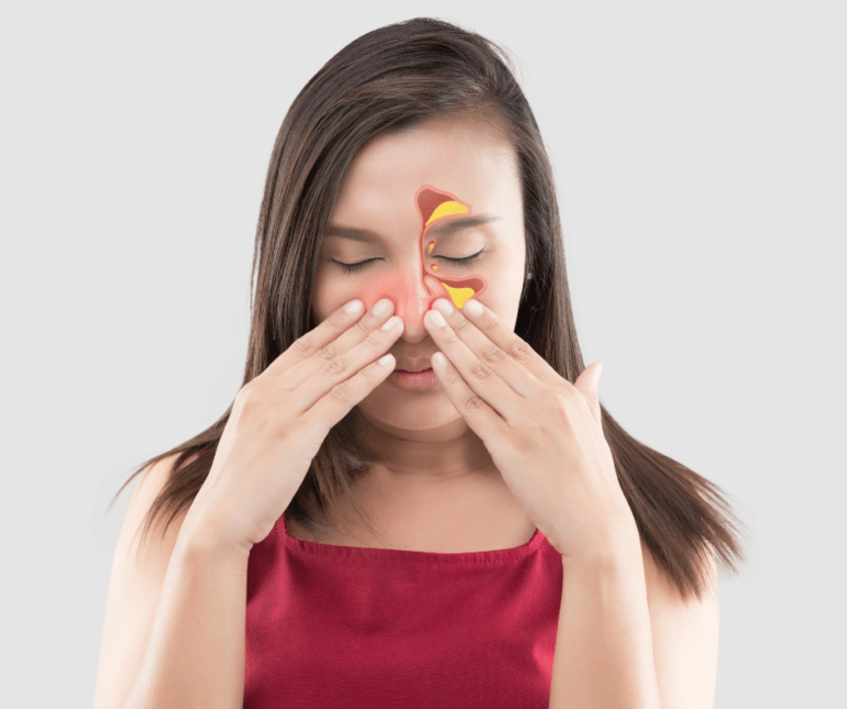 Understanding Allergic Rhinitis: Causes, symptoms, and treatments ...